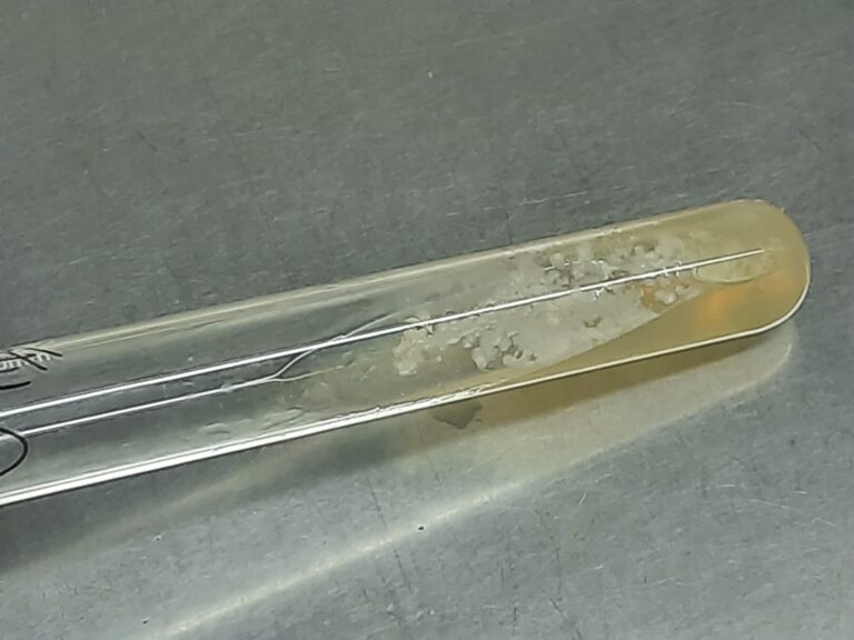BAL Sample vs Sputum Sample – Key Differences