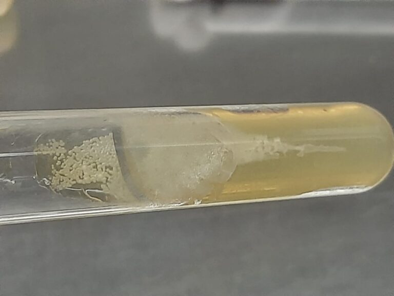 Isolation and Preliminary Identification of Bacterial and Yeast
