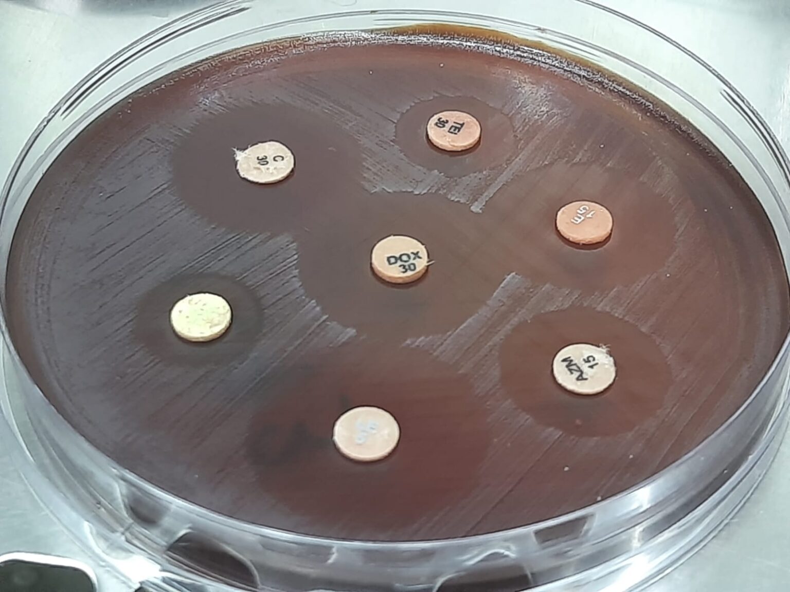 Lactococcus garvieae: Introduction, Pathogenicity, Lab Diagnosis