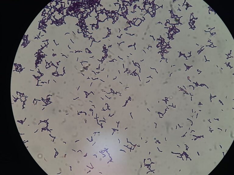 Rothia kristinae: Introduction, Pathogenicity, Lab Diagnosis