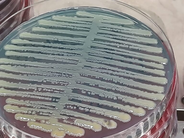 Klebsiella aerogenes : Introduction, Morphology, Pathogenicity, Lab
