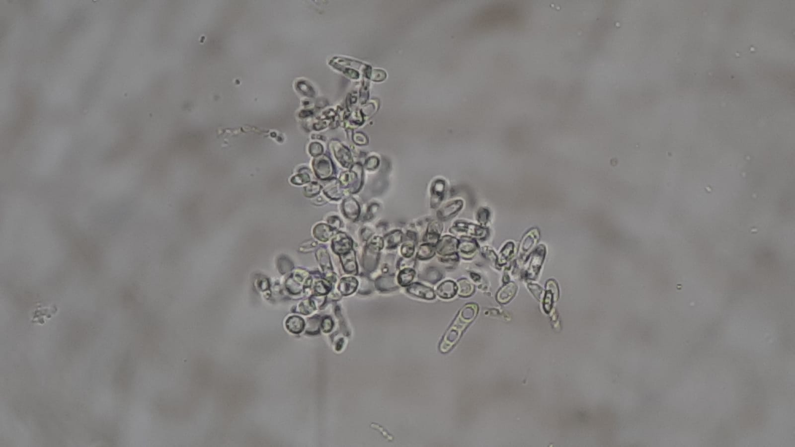 Pichia kudriavzevii-Introduction, Morphology, Pathogenicity, Lab